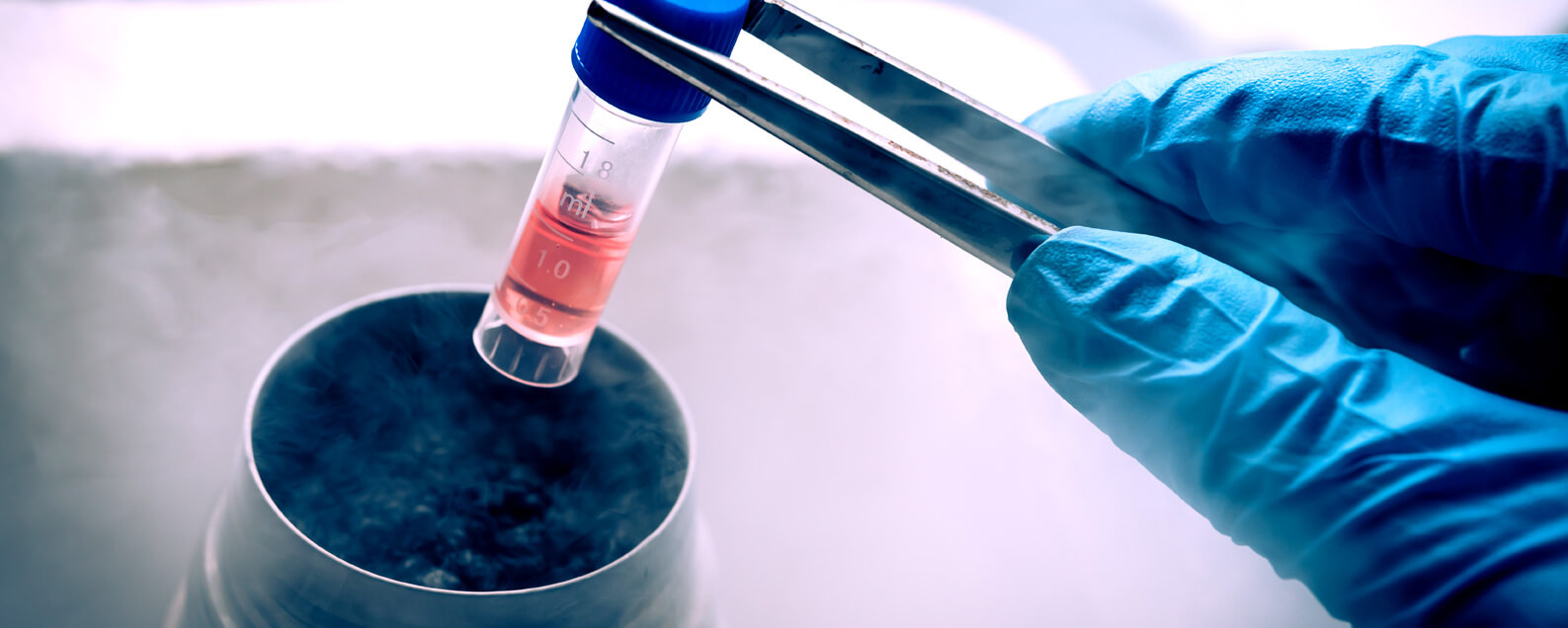 Stem Cell Collection - Medserve Sri Lanka